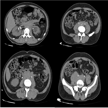 Index of /full-text/UroNephrology/images
